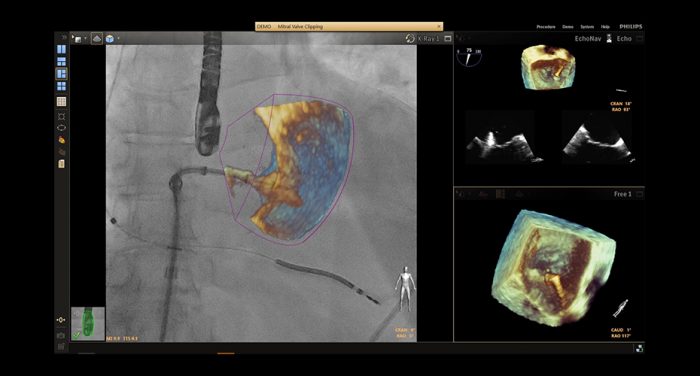 CVS Medical | CVS Medical Malaysia - Philips EPIQ CVxi