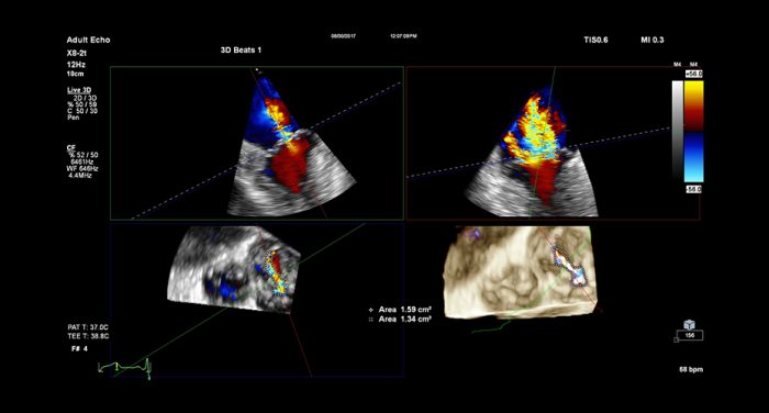 CVS Medical | CVS Medical Malaysia - Philips EPIQ CVxi