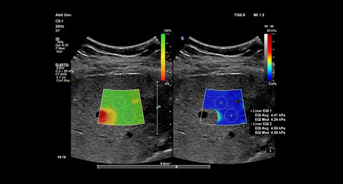 CVS Medical | CVS Medical Malaysia - Philips EPIQ Elite
