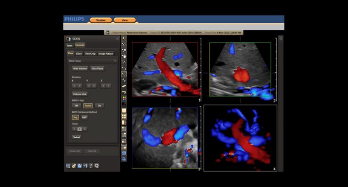 CVS Medical | CVS Medical Malaysia - Philips QLAB